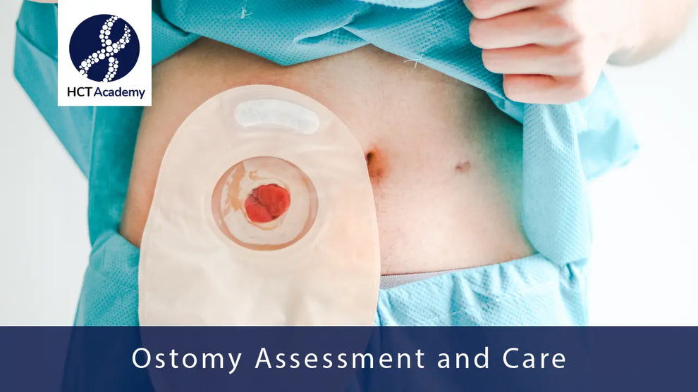 Ostomy Assessment and Care - HCT Academy